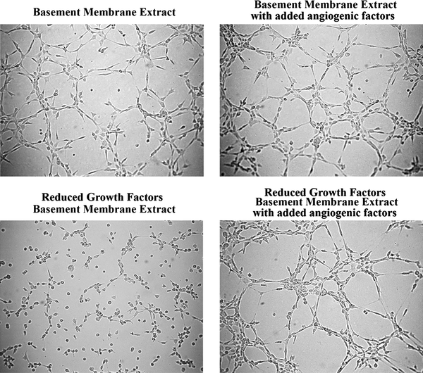 The endothelial cell tube formation assay on basement membrane turns 20 ...