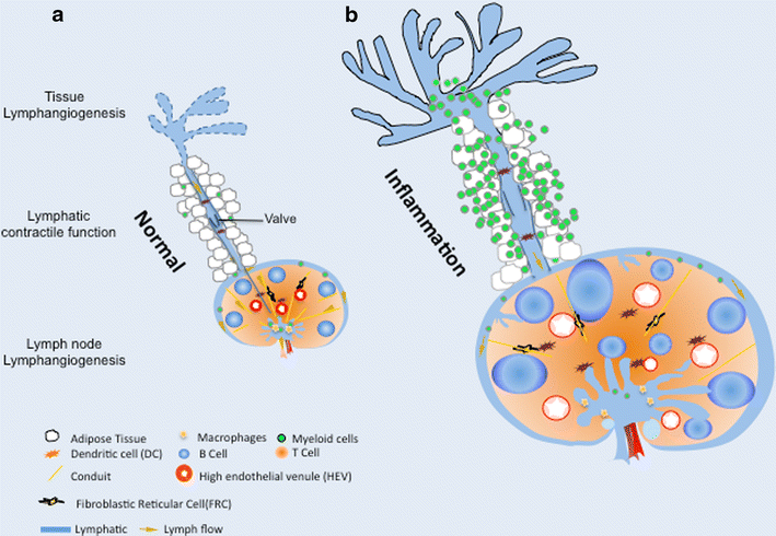 Inflammation-induced lymphangiogenesis and lymphatic dysfunction ...