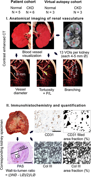 Contrast-enhanced CT imaging in patients with chronic kidney disease ...