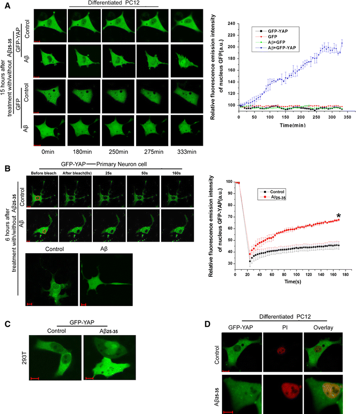 YAP accelerates Aβ25–35-induced apoptosis through upregulation of Bax ...