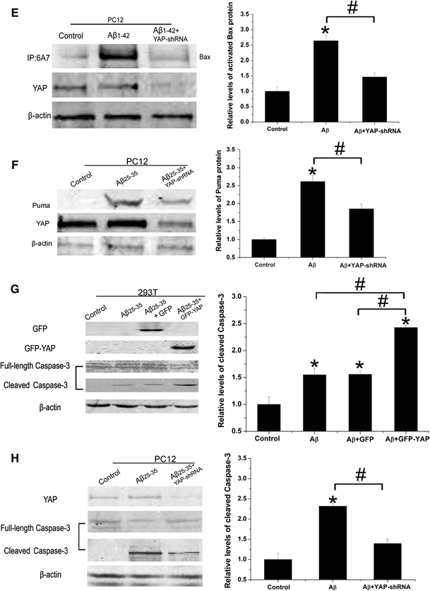 YAP accelerates Aβ25–35-induced apoptosis through upregulation of Bax ...