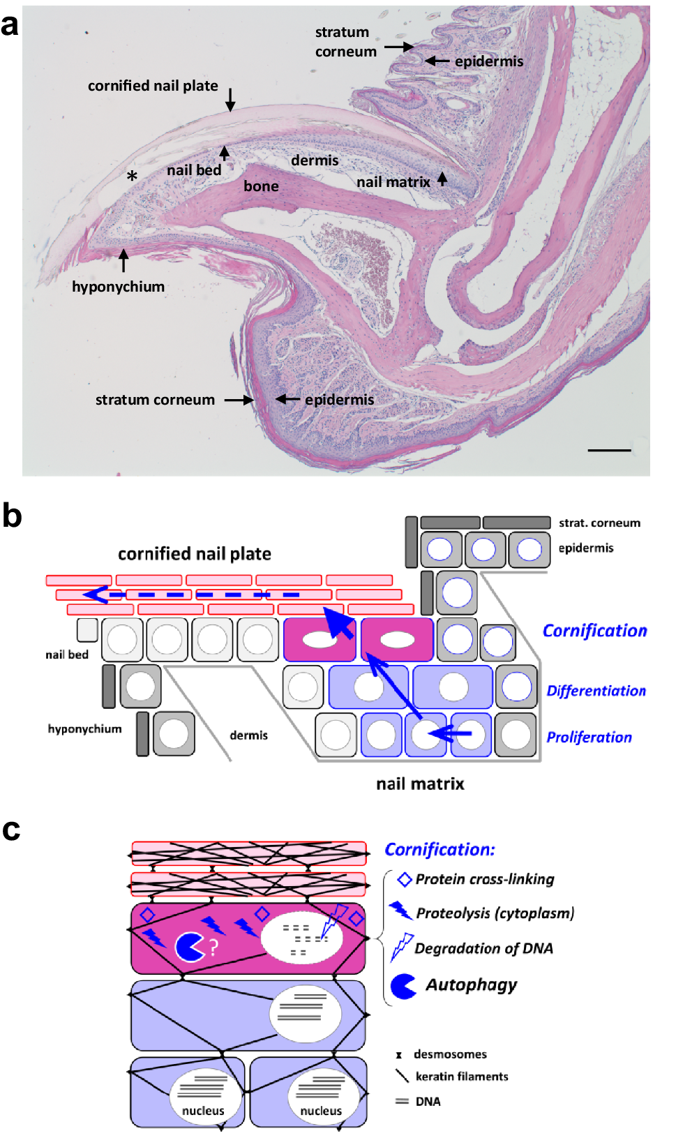 Cornification of nail keratinocytes requires autophagy for bulk ...