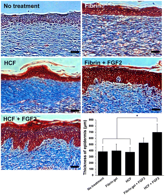 Skin regeneration with fibroblast growth factor 2 released from heparin ...