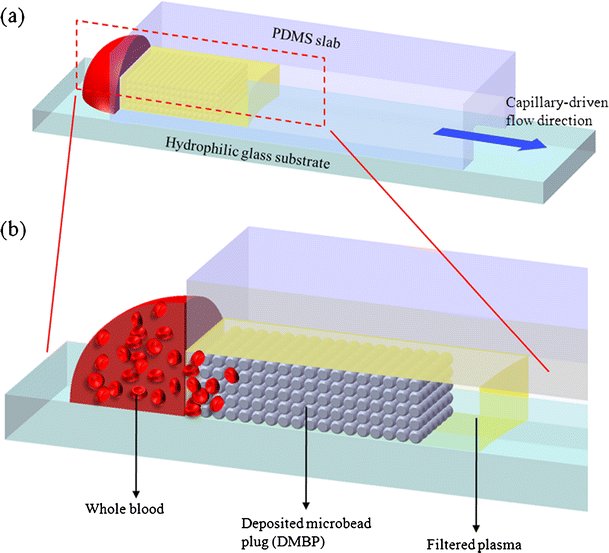 Extraction of plasma from whole blood using a deposited microbead plug ...