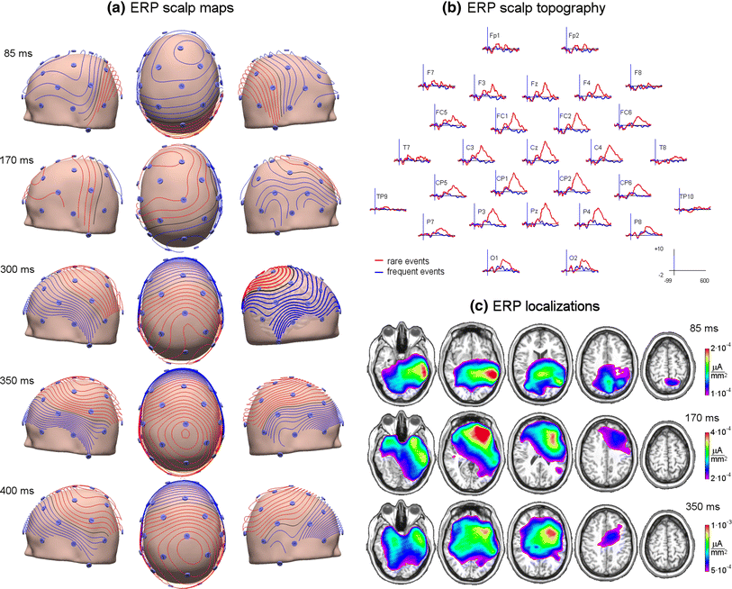 Multimodal Integration of fMRI and EEG Data for High Spatial and ...