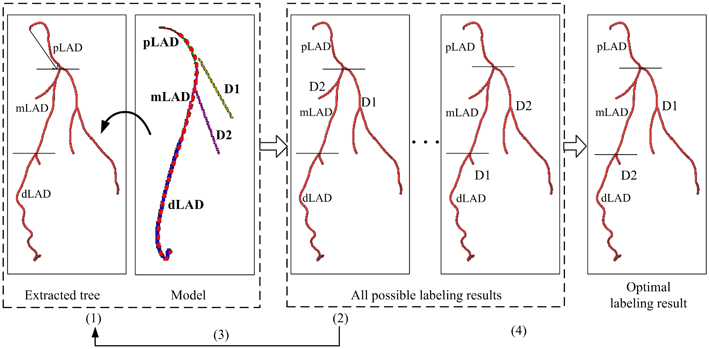 Automatic identification of coronary tree anatomy in coronary computed ...