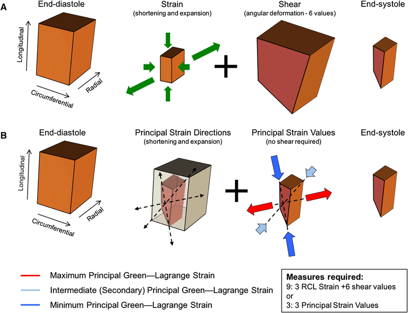 Clinical feasibility and validation of 3D principal strain analysis ...