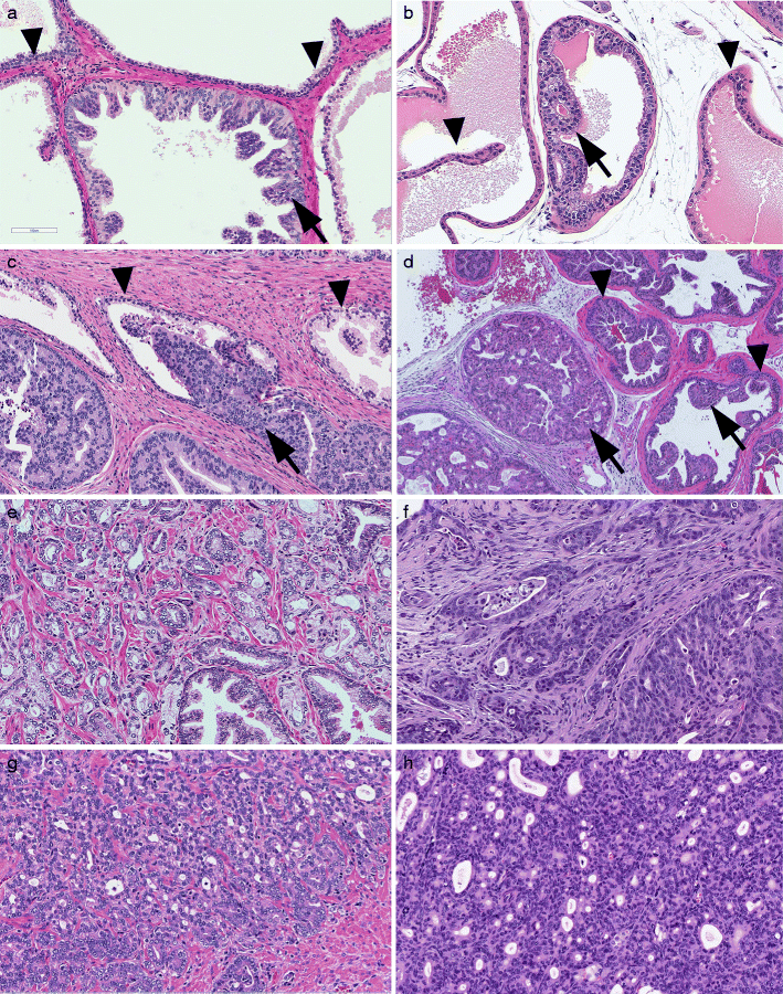Mouse models of prostate cancer: picking the best model for the ...