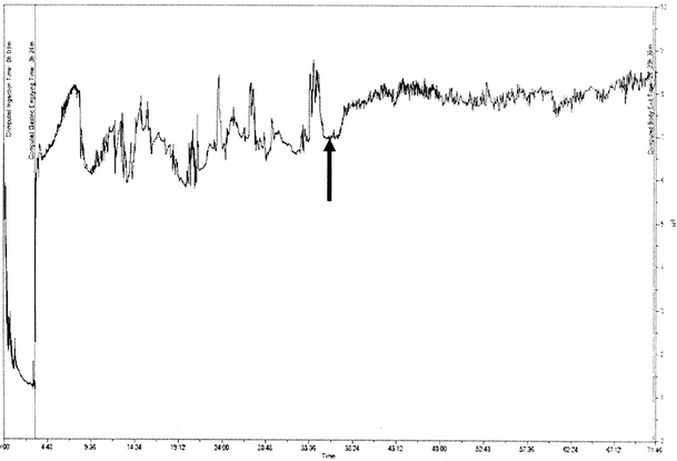 Wireless Capsule Motility: Comparison of the SmartPill® GI Monitoring ...