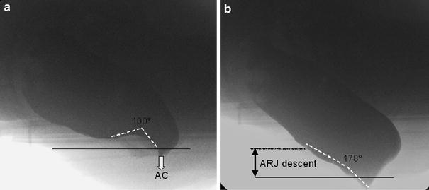 The Physiology of Human Defecation | SpringerLink