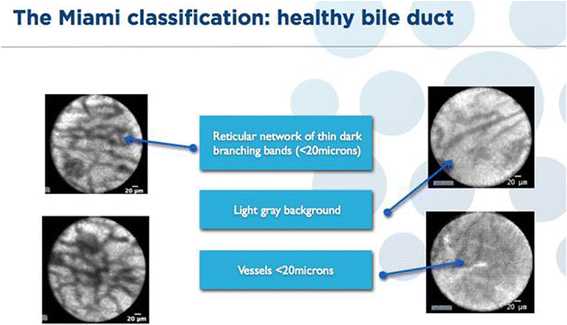 Refined Probe-Based Confocal Laser Endomicroscopy Classification for ...