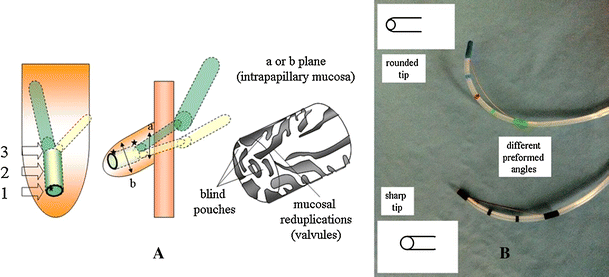 The Comparison of Two Different 5.5 Fr Sphincterotomes for Selective ...