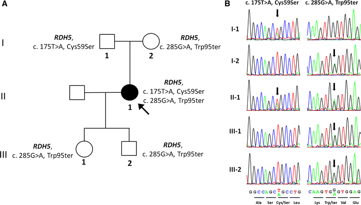 Multimodal fundus imaging in fundus albipunctatus with RDH5 mutation: a ...