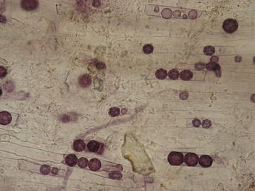 Evidence of olive mild mosaic virus transmission by Olpidium brassicae ...