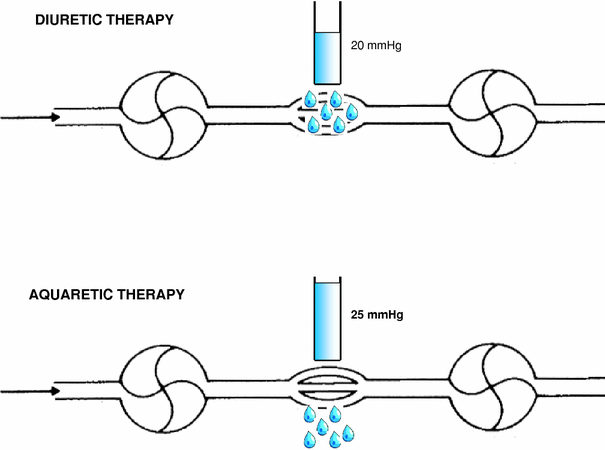 Why, when, and how to assess pulmonary congestion in heart failure ...