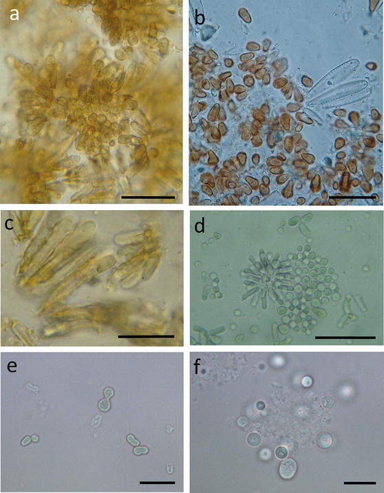 Single colony genetic analysis of epilithic stream algae of the genus ...