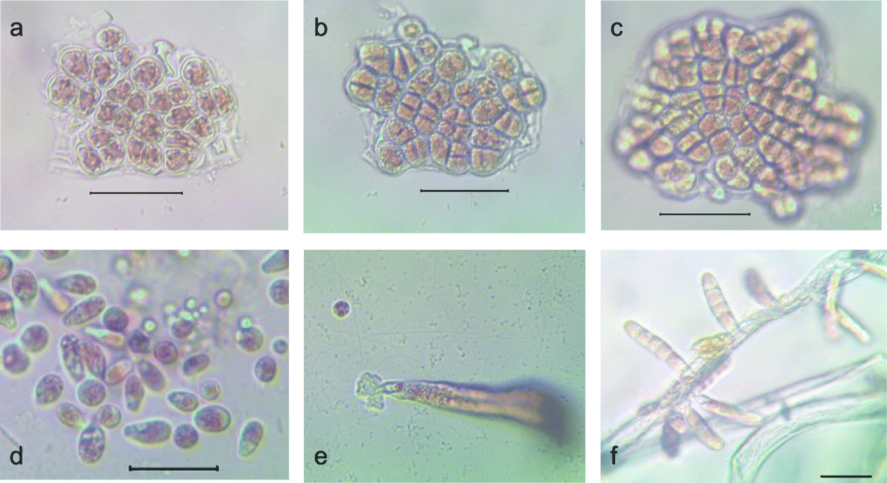 Thallus sectioning as an efficient monospore release method in Pyropia ...