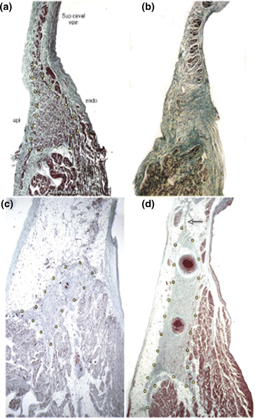Current concepts of anatomy and electrophysiology of the sinus node ...