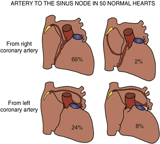 Current concepts of anatomy and electrophysiology of the sinus node ...