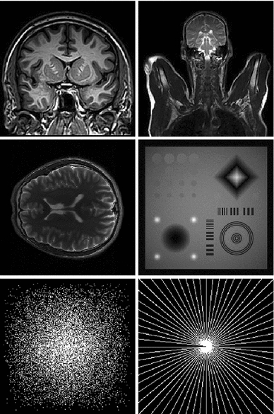 Decoupled Algorithm for MRI Reconstruction Using Nonlocal Block ...