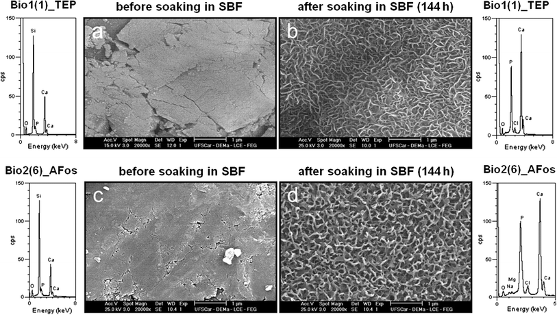 The influence of phosphorus precursors on the synthesis and bioactivity of SiO2–CaO–P2O5 sol–gel ...