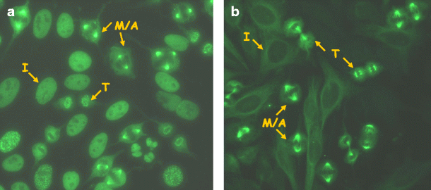 Antibodies to Mitotic Spindle Apparatus: Clinical Significance of NuMA ...