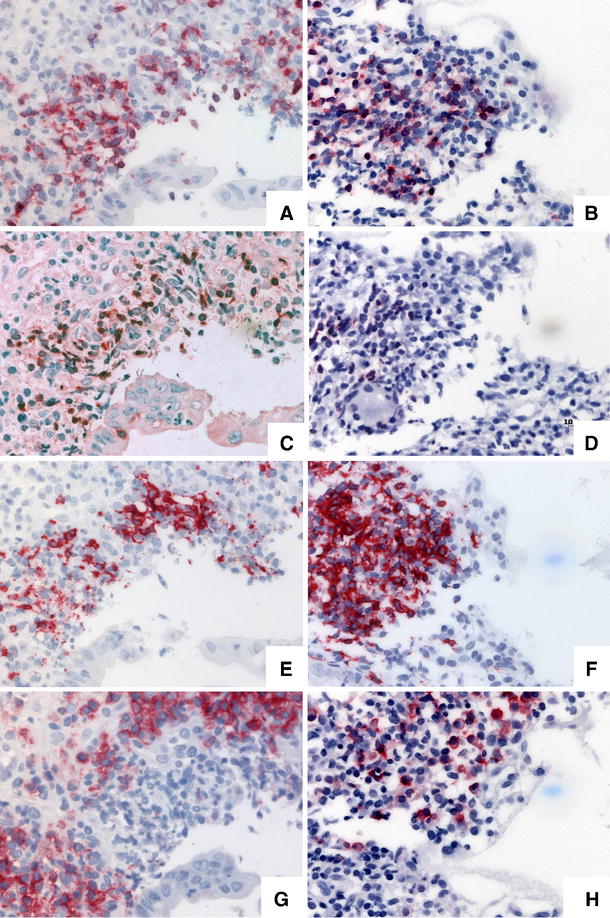 Chronic Inflammatory Bowel Disease as Key Manifestation of Atypical ...