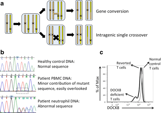 Recent Advances in DOCK8 Immunodeficiency Syndrome | SpringerLink
