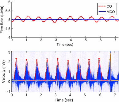In vitro evaluation of an ultrasonic cardiac output monitoring (USCOM ...