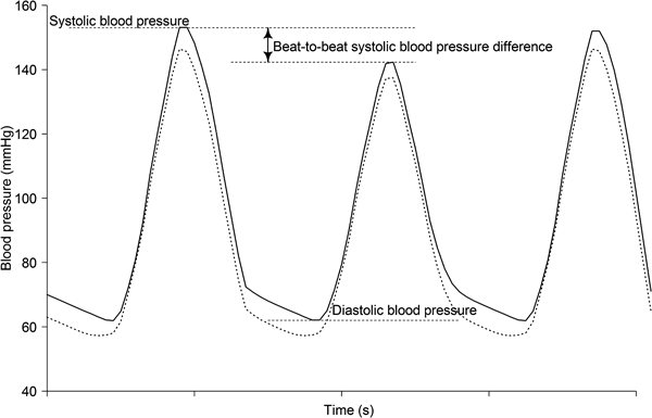Comparing volume-clamp method and intra-arterial blood pressure ...
