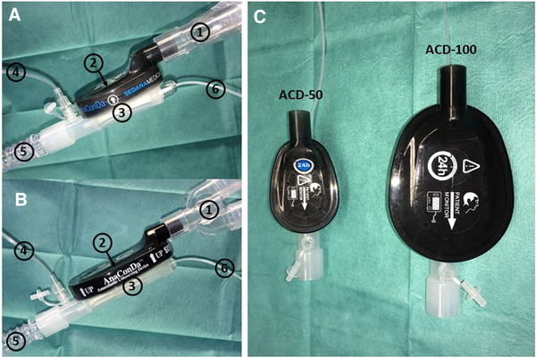 Halving the volume of AnaConDa: initial clinical experience with a new ...