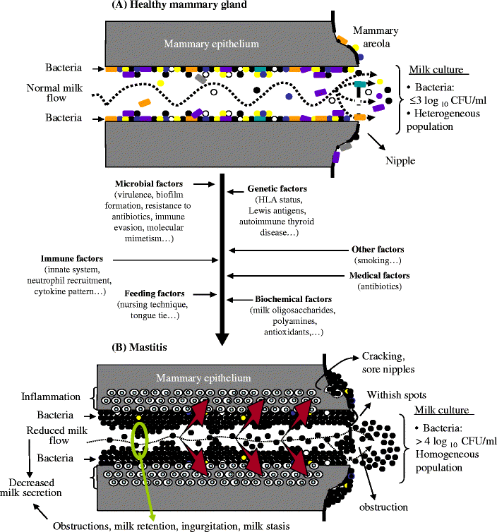 Mastitis: Comparative Etiology and Epidemiology | SpringerLink