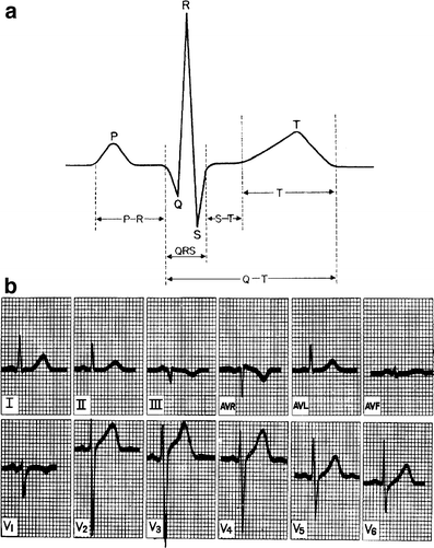 The Programmable ECG Simulator | SpringerLink