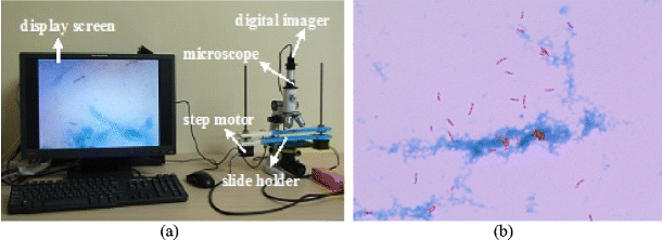 A Review of Automatic Methods Based on Image Processing Techniques for ...