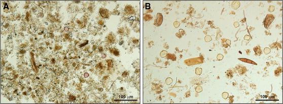 Rapid determination of the pollen content in lake sediment cores as a ...