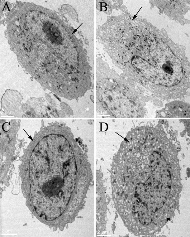 Endoplasmic reticulum stress leads to lipid accumulation through ...