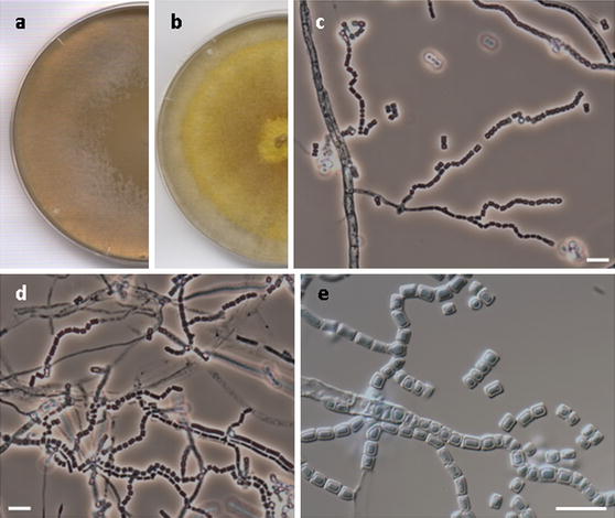 Rare Arthroconidial Fungi in Clinical Samples: Scytalidium cuboideum ...
