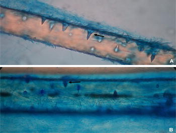 The Use of Albino Adult Hair and Blond Prepubertal Hair Yields ...