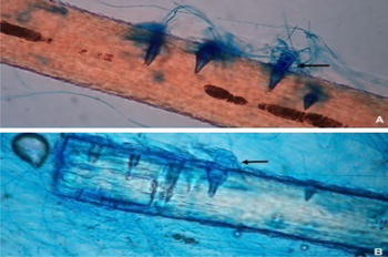 The Use of Albino Adult Hair and Blond Prepubertal Hair Yields ...