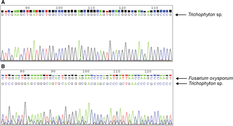 Diagnosis of Dermatophytosis Using Molecular Biology | SpringerLink