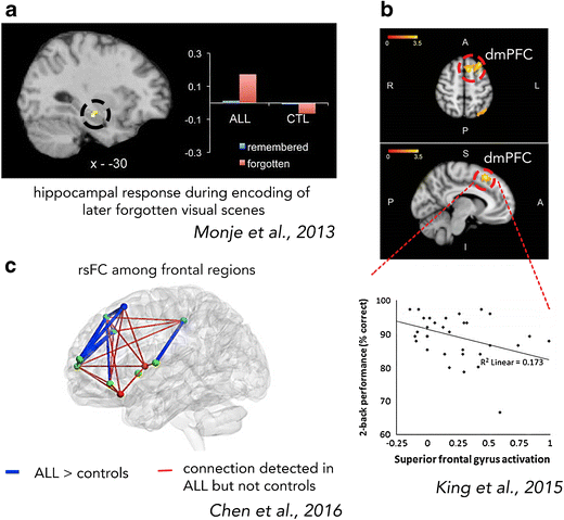 Neurodevelopmental consequences of pediatric cancer and its treatment ...