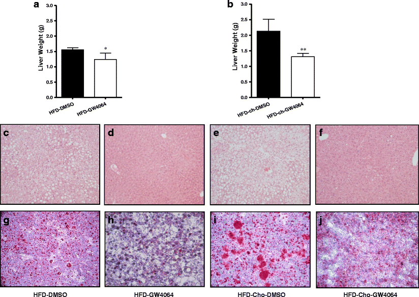 Synthetic FXR Agonist GW4064 Prevents Diet-Induced Hepatic Steatosis ...