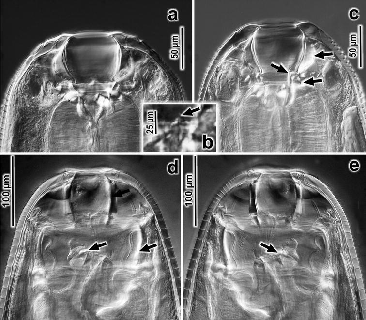 Morphology and diagnosis of some fourth-stage larvae of cyathostomines ...