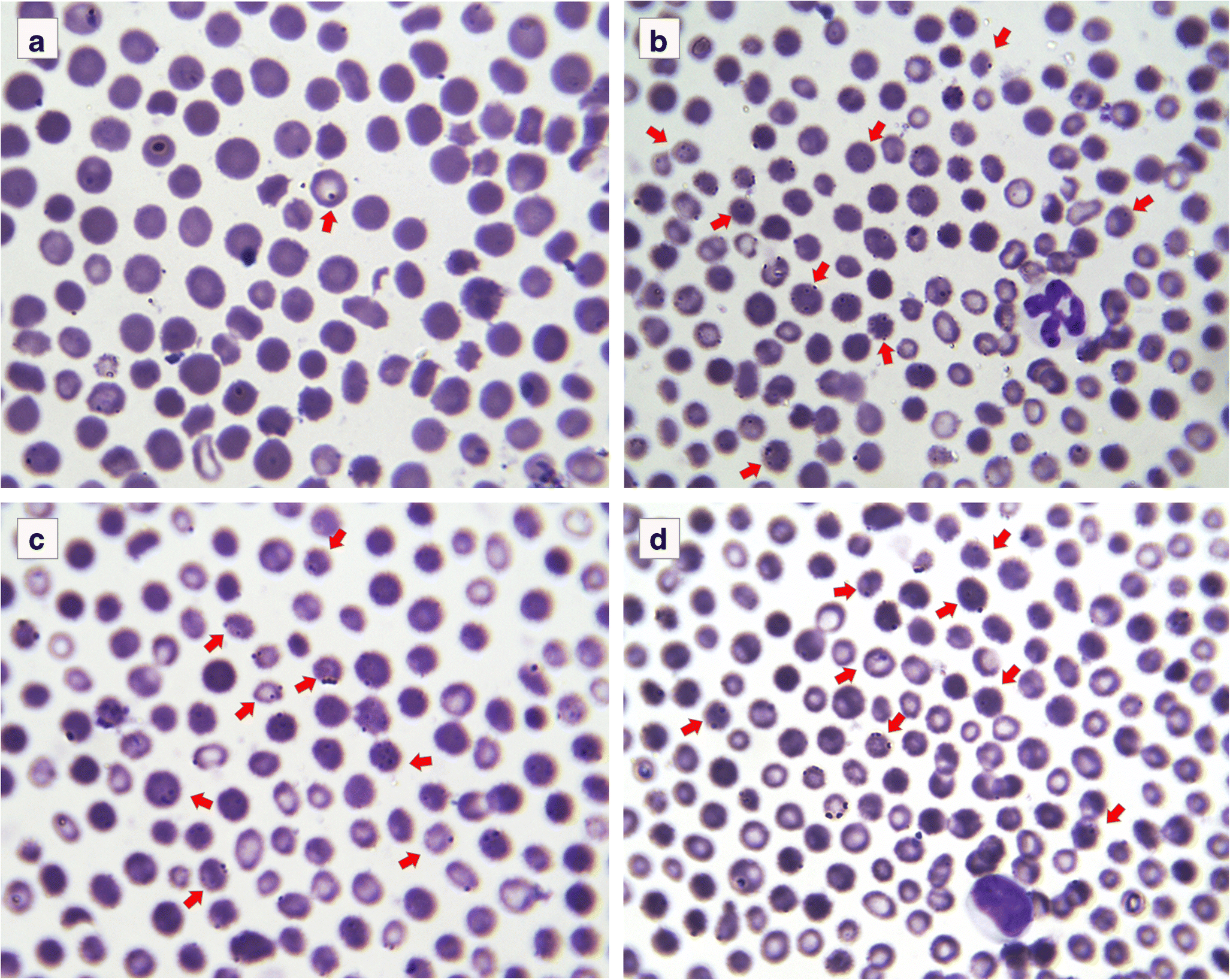 Molecular detection of Mycoplasma ovis in an outbreak of hemolytic ...