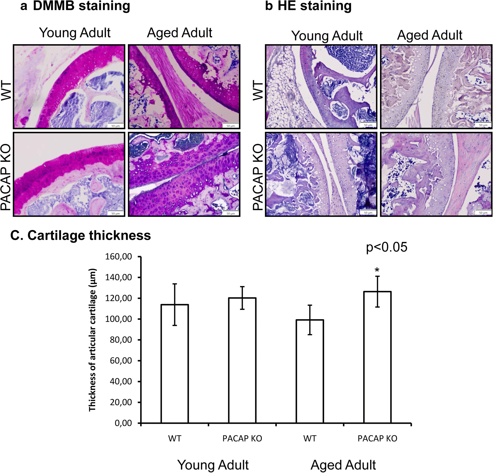 Age-related alterations of articular cartilage in pituitary adenylate ...
