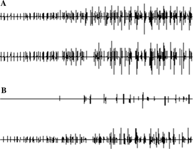 MUAP extraction and classification based on wavelet transform and ICA ...