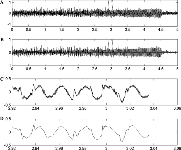 MUAP extraction and classification based on wavelet transform and ICA ...