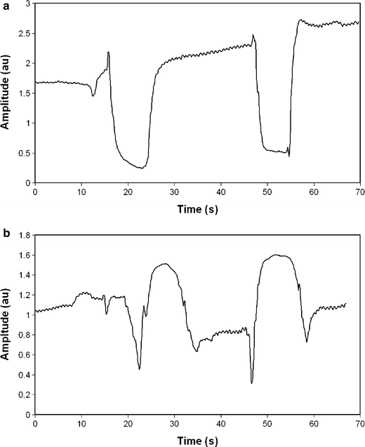 An electrooptical muscle contraction sensor | SpringerLink