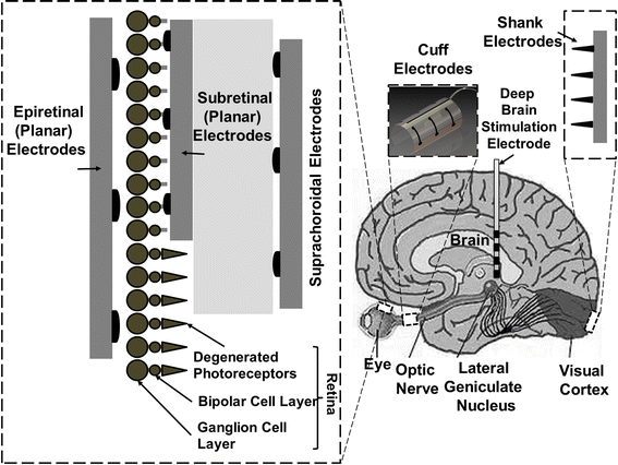 Implantable neurotechnologies: electrical stimulation and applications ...