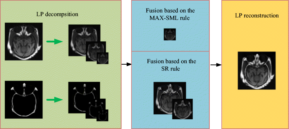 A sum-modified-Laplacian and sparse representation based multimodal ...